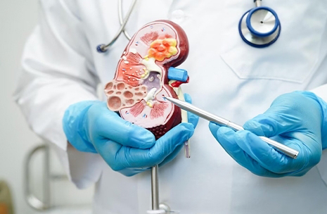 Renal Calculi - Edamanasserry Spine Hospital - ESH